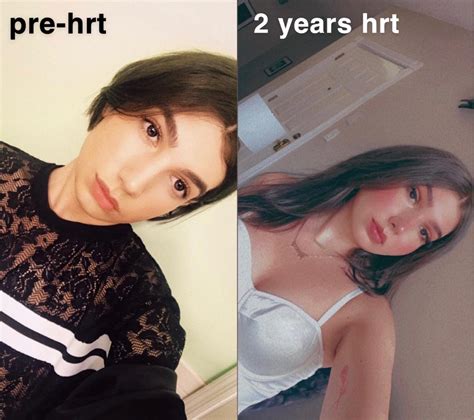2 Years Hrt Mtf R Transtimelines
