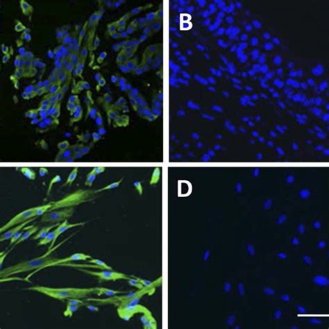 Double Immunoflurescence Staining In Human Urothelium And Cultured