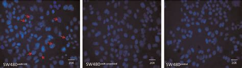 Mir 126 Induced Apoptosis In Colon Cancer Cells The Dapi Staining Of