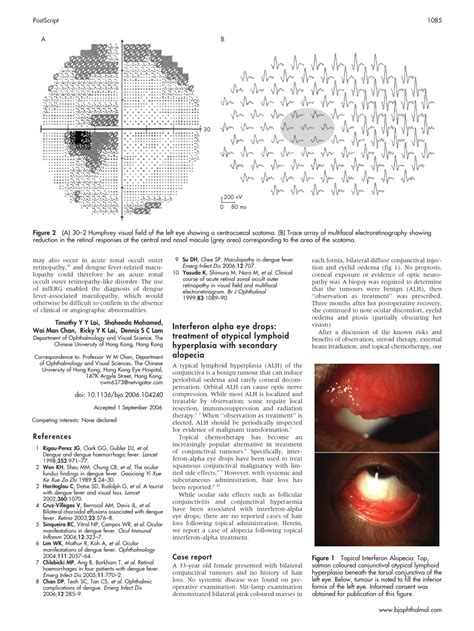 Pdf Interferon Alpha Eye Drops Treatment Of Atypical Lymphoid Hyperplasia With Secondary