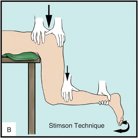 Chapter Pelvic Trauma Anesthesia Key