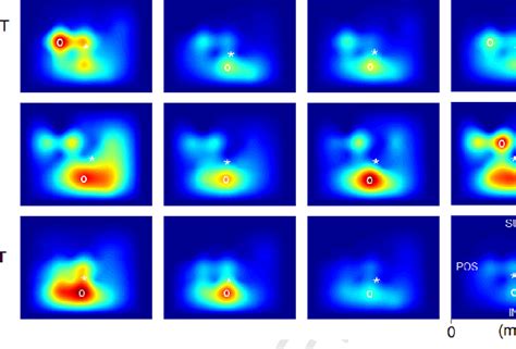 Grand Average Of Statistical Parametric Maps The Color Coded Maps Show