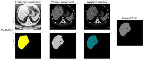 Enhancing Diagnostic Images To Improve The Performance Of The Segment