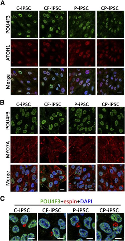 Differentiation Of Otic Epithelial Progenitors Into Hair Celllike