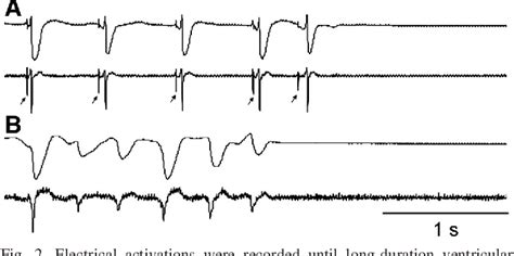 Figure 1 From Chemical Ablation Of The Purkinje System Causes Early Termination And Activation