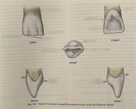 Permanent Maxillary Right Central Incisor Multiple Views Diagram Quizlet