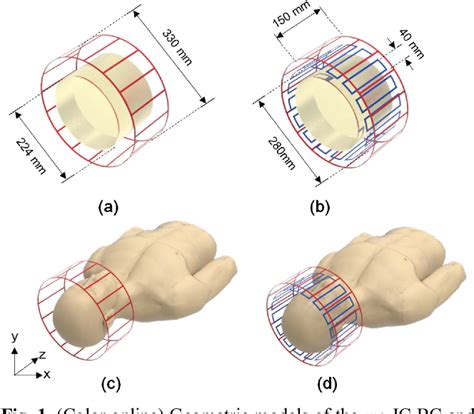 Figure 1 From Birdcage Coil With Inductively Coupled Rf Coil Array For Improving B₁ Field