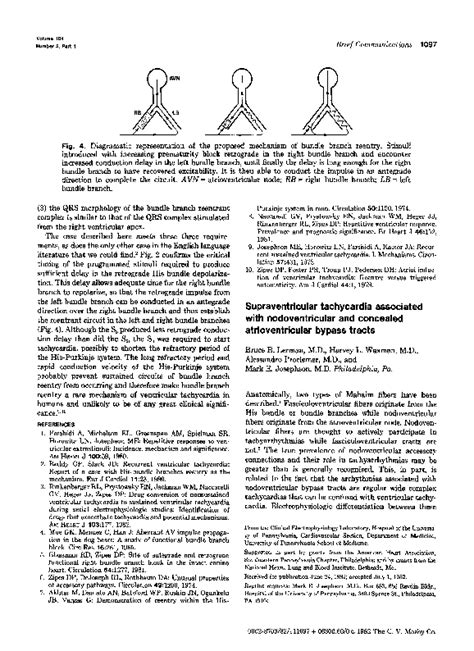 Pdf Supraventricular Tachycardia Associated With Nodoventricular And