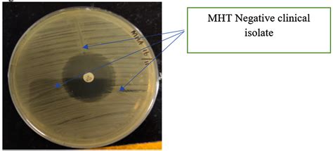 Comparison Of Three Phenotypic Methods Of Carbapenemase Enzyme Detection To Identify Carbapenem