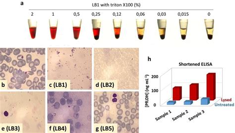 Optimization Of Rbc Lysis A Effect Of The Concentration Of Triton