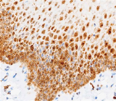 Enzo Announces Collaboration With Roche Diagnostics France For The Validation Of Their Ampiview