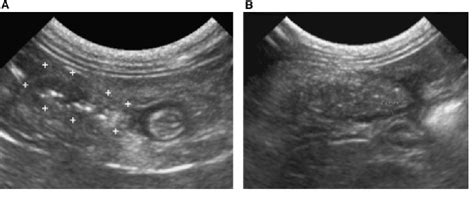 Ultrasonographic Characterization Of Feline Ileocecocolic Abnormalities Semantic Scholar
