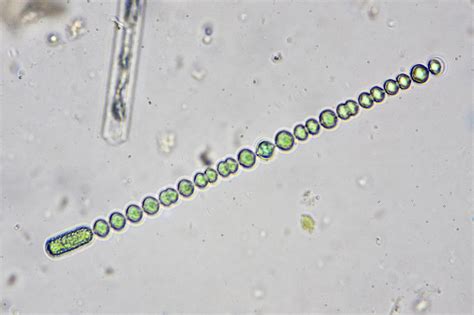 Anabaena Circinalis The Microscopic Life Of Shetland Lochs