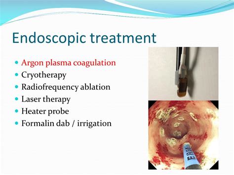 Ppt Joint Hospital Surgical Grand Round Radiation Proctitis
