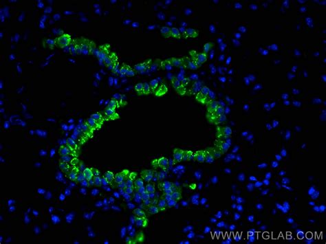 Uteroglobincc10 Antibody Cl488 10490 Proteintech 武汉三鹰生物技术有限公司