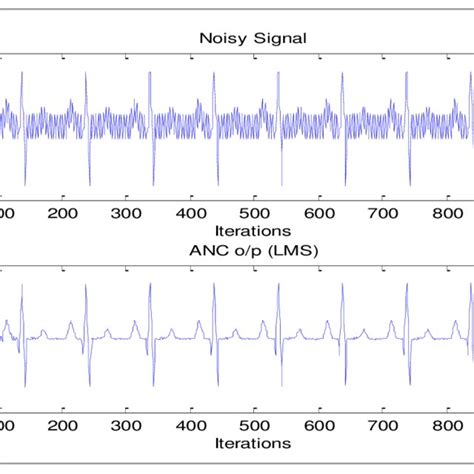 Complete Noise Free Ecg Signal And Ecg Signal Corrupted With Power Line