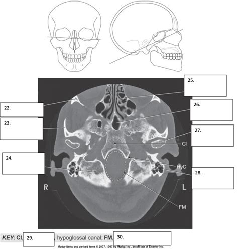 Cross Sectional Unit Chapter Fig Diagram Quizlet