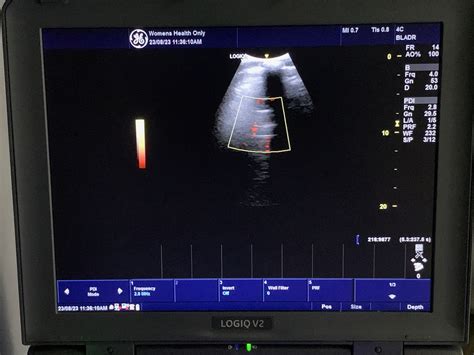 Ge C Rs Ultrasound Probe Transducer Auschoice