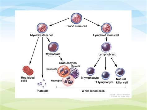 Acute Lymphoid Leukemiapptx Based On Internal Medicine Pptx