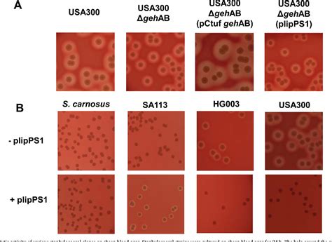 Alpha Hemolytic Staph