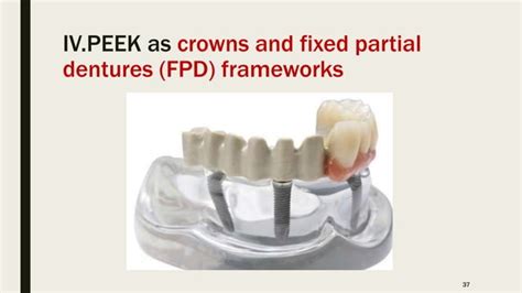Peek Polyetheretherketone Applications In Clinical Dentistry Pptx