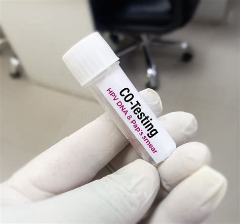 Vaginal Fluid Sample For Co Testing Hpv Dna Test And Paps Smear Test