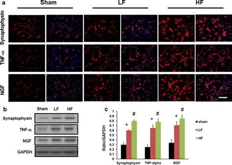 Expression Of Synaptophysin Tnf α And Ngf In Dorsal Root Ganglion Cell