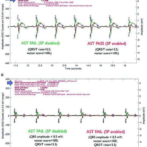 Different Automated Screening Tool Outcomes Depending On If Signal Was