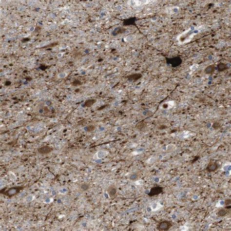 Rabbit Polyclonal Anti Dcp1a Antibody Buy For Research Highly Specific Rigorously Validated