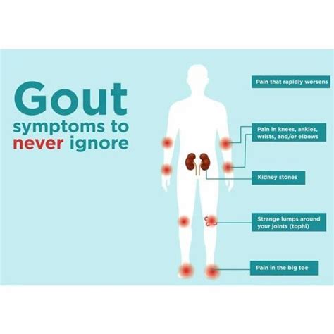 Uric Acid Tablet Packaging Type Plastic Bottle Twice A Day At ₹ 85