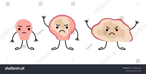 Stage Growth Polyp Small Big Danger Stock Vector Royalty Free 2479847643 Shutterstock