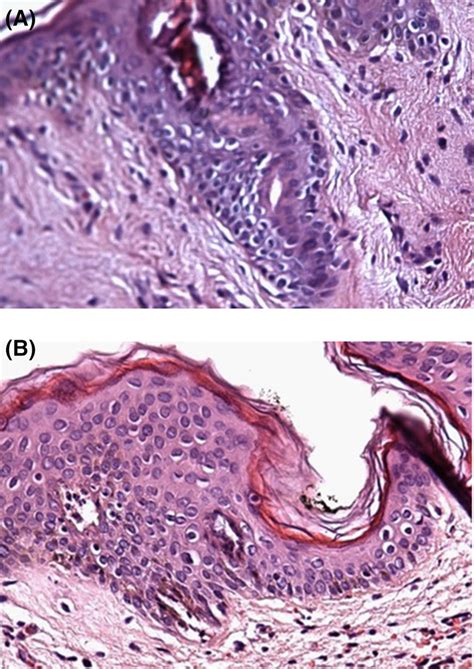 Epidermis Biology For Majors Ii