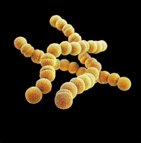 Streptococcus Pyogenes Bacteria 1 Photograph By Science Photo Library
