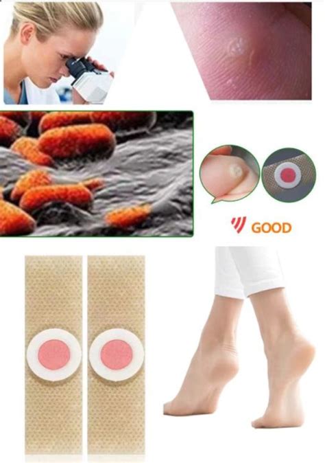 Foot Care Stickers Plaster Corns Patches Foot Corn Removal Plaster