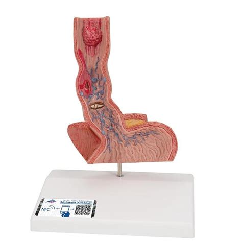 Digestive System Models Human Digestive System Models Tagged