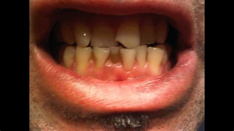 פה גדול מאיר אריאל Youtube