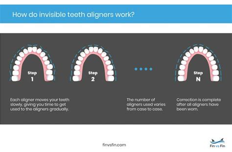 Candid Vs Byte Vs Invisalign The Best Teeth Aligner Kit For Your Budget Fin Vs Fin