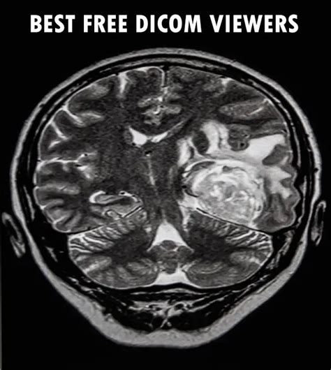 Best Free Dicom Viewers Reviews Pros And Cons