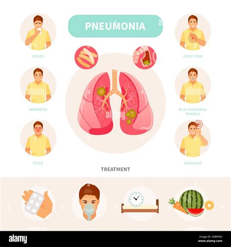 Male Character With The Symptoms And Treatment Of Pneumonia Vector Medical Infographics Poster