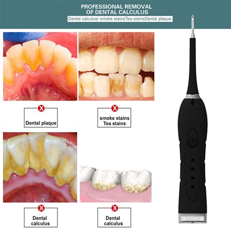 Portable Electric Dental Scaler Clean Tooth Travel Vicedeal