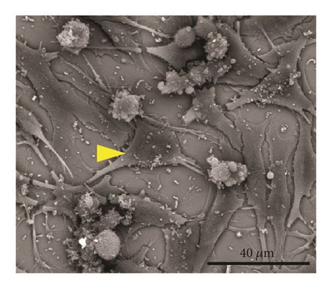 Interaction Of Hmvii Cells With U Urealyticum Lamp With And Without L