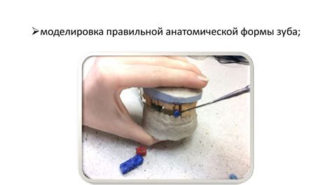 ВКР Изготовление цельнолитого комбинированного металлопластмассового