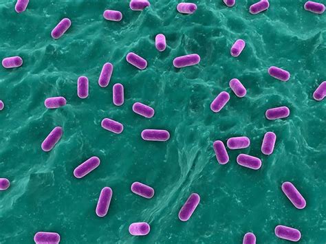 Bacillus Coagulans 増殖 Bacillus Coagulans 意味 Zrufw