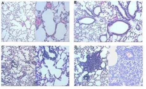 Ltb4 Loaded Ms Provoke Leukocyte Infiltration In The Lung Parenchyma