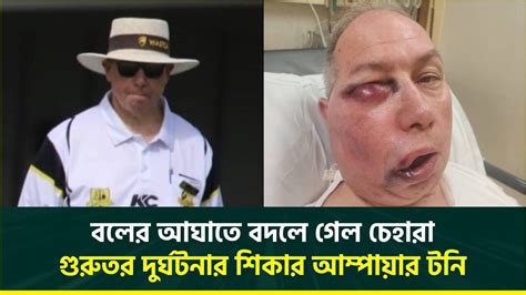 মাথায় বলের আঘাতে গুরুতর আহত আম্পায়ার অল্পের জন্য প্রাণে বাঁচলেন