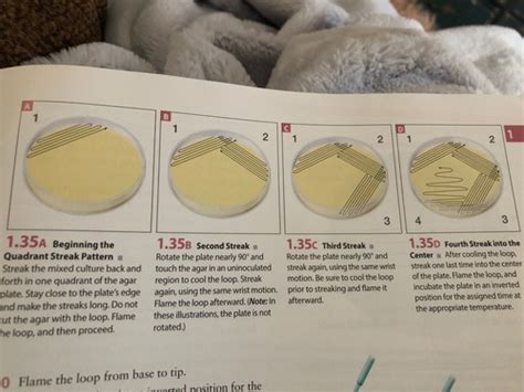 Week 4 Micro Lab Quiz 2 2 Flashcards Quizlet