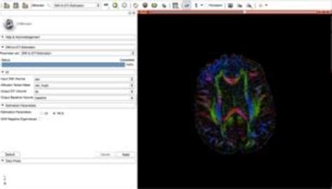 Osirix Lite Segmentation