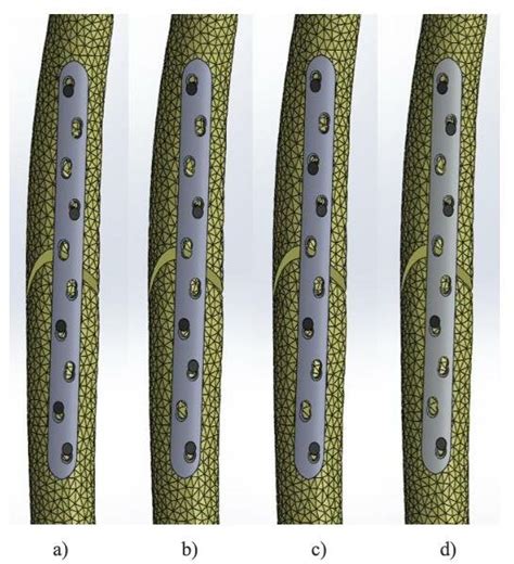 Four Different Types Of Screw Arrangement Using 5 Screws A Screw Download Scientific Diagram