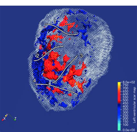 3d Multiplanar Reconstruction Download Scientific Diagram