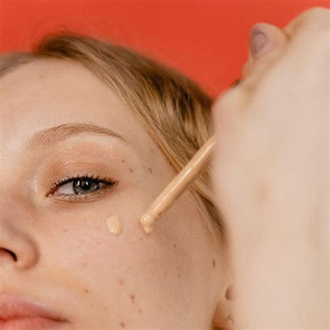Papules Vs Pustules Understanding And Treating Inflammatory Pimples